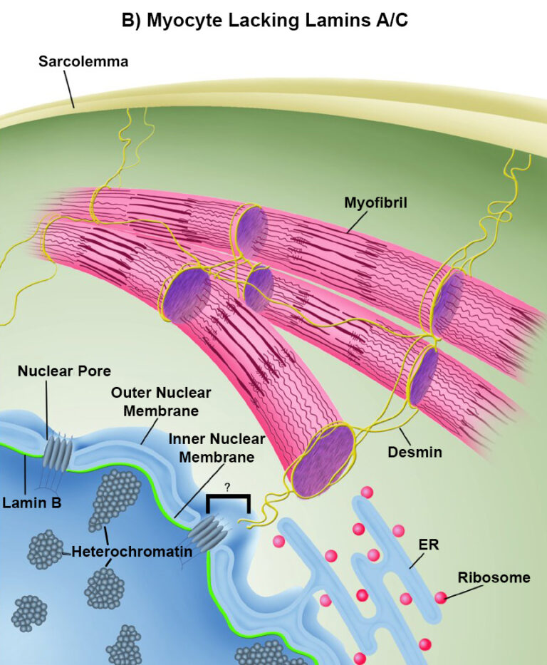 Introduction to LMNA – LMNA Cardiac
